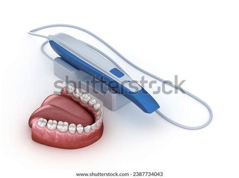 Intraoral Teeth 3d Scanner My Own Stock Illustration 2387734043