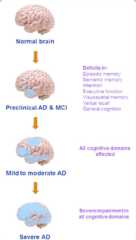 Progression Of Neuropathology And Cognitive Impairment In Ad The