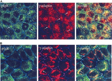 Confocal Immunofluorescence Microscopy Analysis Of Co Localization Download Scientific Diagram