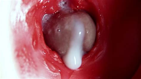 Mini Camera In The Butthole Intense Anal Orgasm With A Creampie Is