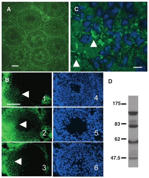 Localization Of The Cd36 Protein In The Adult Testis Ab