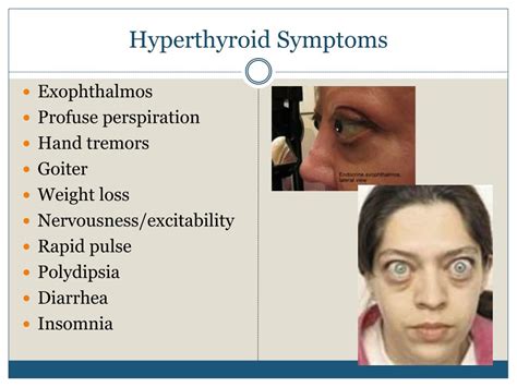 Ppt Thyroid Disorders Powerpoint Presentation Free Download Id4435536