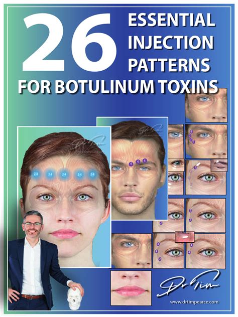 26 Essential Botox Injection Patterns Pdf Botulinum Toxin Eyebrow