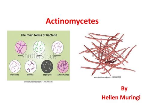 Actinomycetes Bacteria Lecture Teaching Notes Pptx