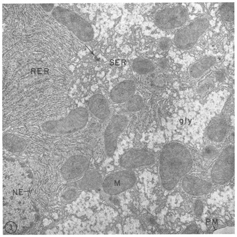 Electron Micrograph Of A Hepatocyte From An Adult Liver Fixed By Download Scientific Diagram