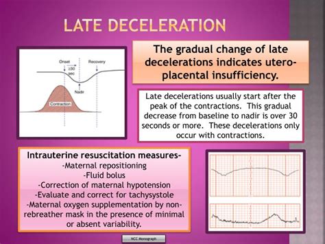 Ppt Electronic Fetal Monitoring Powerpoint Presentation Id3156047