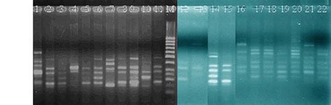 Rams Banding Patterns Generated By Primer Lr 5 Of Trichoderma Isolates Download Scientific