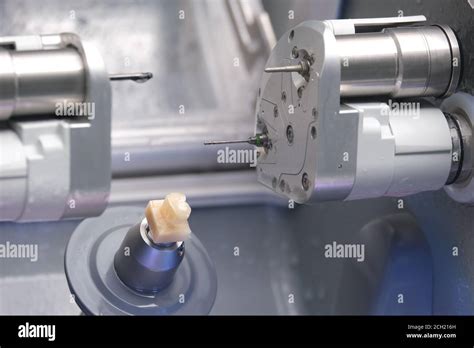 Cad Cam Dental Computer Aided Machine Digital Modern Dental Laboratory For Prosthesis And