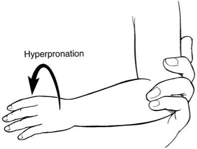 Fast Track Nursemaids Elbow — Brown Emergency Medicine Blog