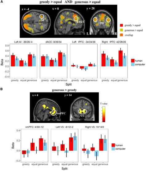 The Effect Of Split On Neural Correlates In Game 1 Glm 3 A Shared