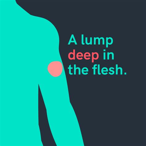 Measuring And Tracking A Lump Sarcoma Uk