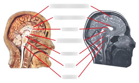 Brain Anatomy Diagram Quizlet