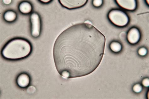 Potato Starch Under Microscope