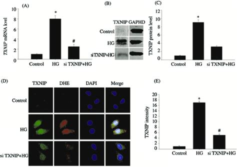 Txnip Expression Levels In Huvec In Different Groups A Txnip Mrna In Download Scientific