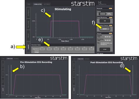 Simultaneous Eeg Monitoring During Transcranial Direct Current Stimulation