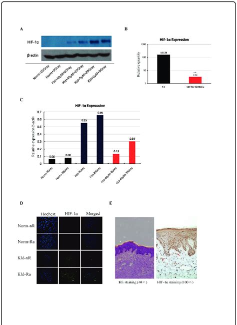 Hif 1α Expression In Keloid Fibroblasts A Western Blot Of Hif 1α Of Download Scientific