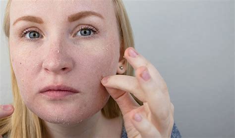 4 Amazing Benefits Of Using Cherry