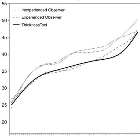 Parallelism Plot Of Mean Retinal Thickness Measurements Of Observers