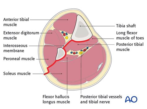 Approach To The Posterolateral Surface Of The Tibia