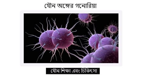 যৌন শিক্ষা এবং চিকিৎসা Sex Treatment And Education হাকিম মোঃ সুজন শিকদার ডি ইউ এম এস