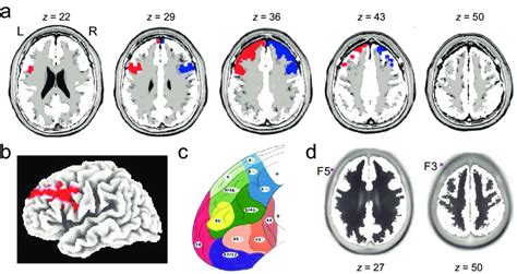 Dorsolateral Prefrontal Cortex Regions Of Interest The Axial Slices In Download Scientific
