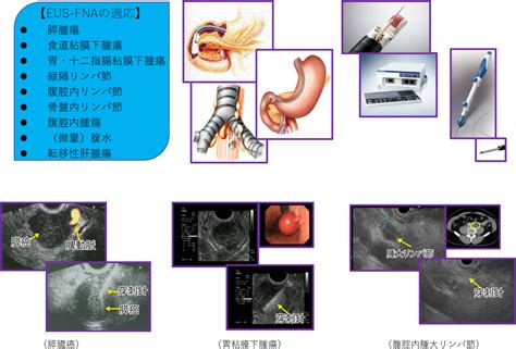 胆膵内視鏡診療 埼玉医科大学国際医療センター 消化器内科（消化器内視鏡科）