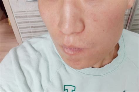 남자 화장품 추천 입큰맨 파워 액티브 아크네 올인원 프로 네이버 블로그