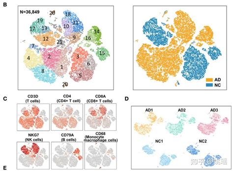 如何用外周血单细胞rna测序揭示阿尔茨海默疾病机制？ 知乎