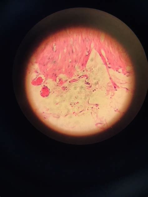 Simple Epithelium Diagram Quizlet