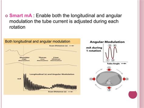 Ct Radiation Dose Reduction Pptx Digital Audio Computer Software And Applications