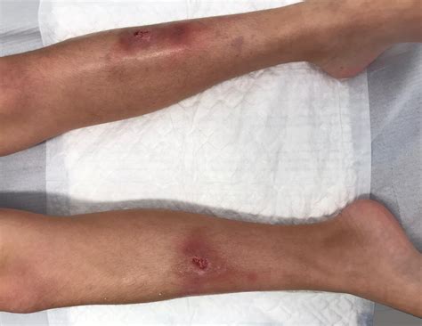 European Journal Of Pediatric Dermatology