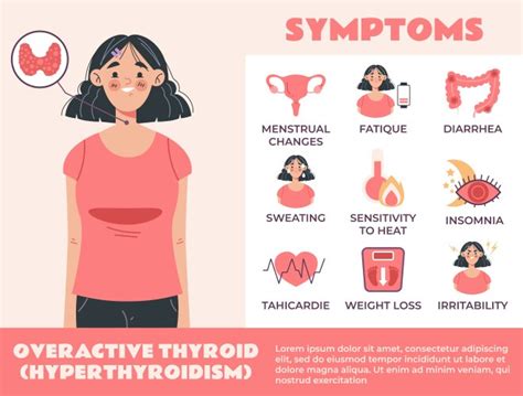 Hyperthyroidism Symptoms Royalty Free Vector Image