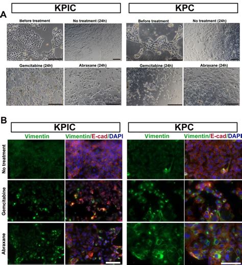 Lsl Krasg12d Lsl Trp53r172h Ink4flox Ptf1 P48 Cre Mice Are An