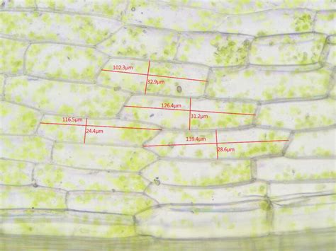 Physcomitrium Patens British Bryological Society
