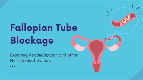 Fallopian Tube Blockage Treatment Without Surgery