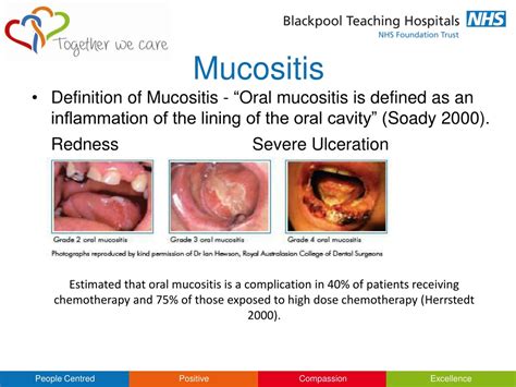 Mucositis Symptoms