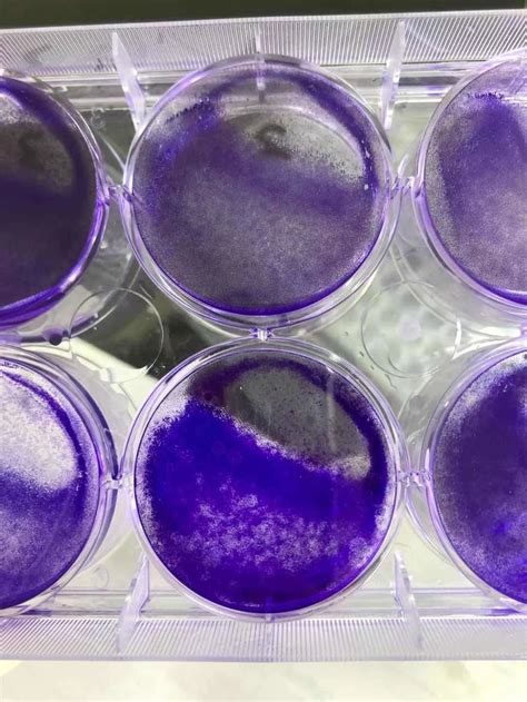 159 Questions With Answers In Plaque Assay Scientific Method