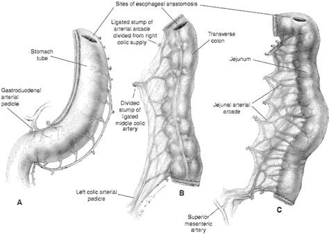 Esophageal Anastomosis Operative Techniques In Thoracic And