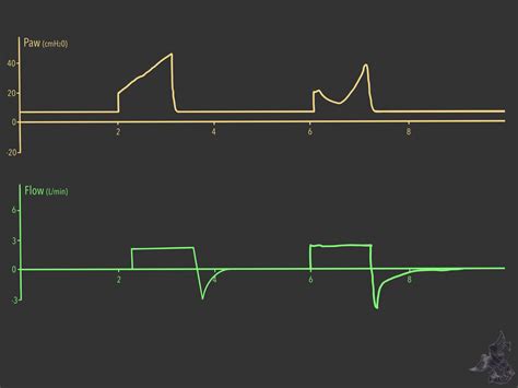 Riding The Waves Waveform Interpretation Part 2 Resusnation