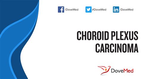 Choroid Plexus Carcinoma
