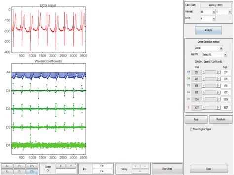 Daubechies 4 Wavelet Representation For Ecg Time Series Record 117 L