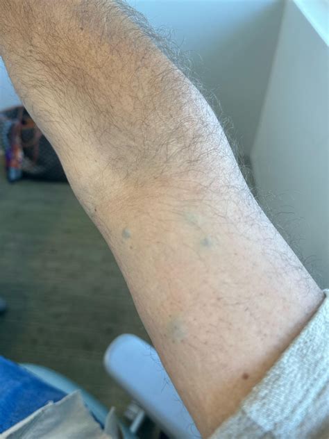 Skin Condition R Dermatologyquestions