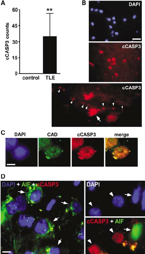 Aif And Endonuclease G Subcellular Localization In Human Tle A