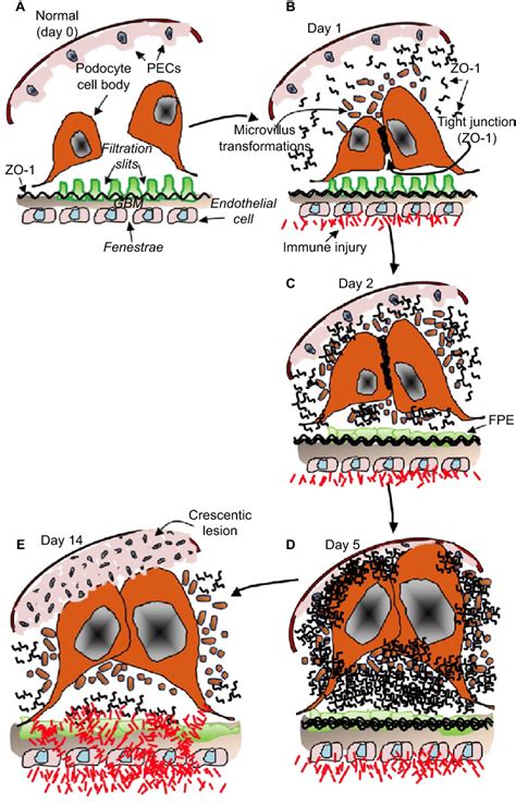 Schematic Diagram Depicting The Early Response Of Podocytes In The Download Scientific Diagram