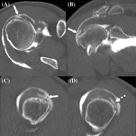 Ct Scan Spiral Joint Ct Arthrogram Prognohealth Corporate Health Ct Scan Spiral Joint Ct Arthrogram Prognohealth Corporate Health