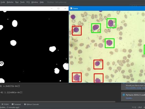 Image Processing And Machine Learning Cnn Projects Using Python Upwork