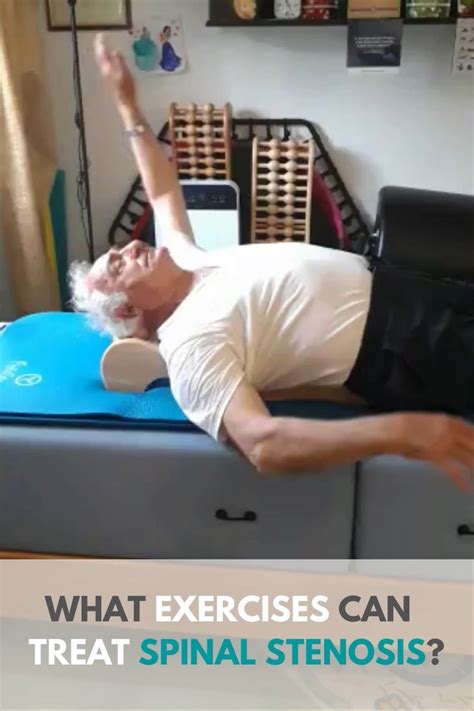 Spinal Stenosis What Is It Symptoms And Treatment Artofit