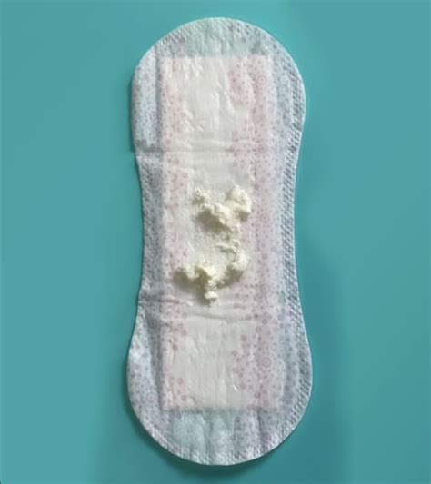 Is Cottage Cheese Like Discharge Normal At Arnetta Parker Blog