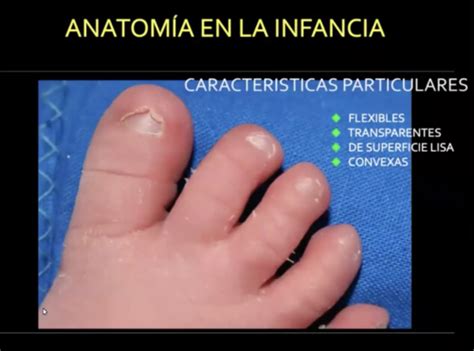 Onicopatias En Niños Quizlet