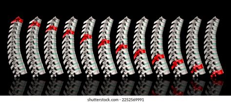 73568 Spine Chart With Numbered Vertebrae Royalty Free Images Stock